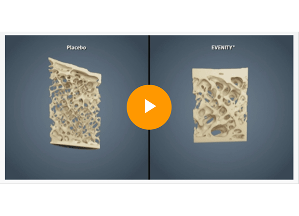 Resources | EVENITY® (romosozumab-aqqg) HCP