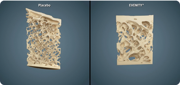 Mechanism of Action (MOA) | EVENITY® (romosozumab-aqqg) HCP